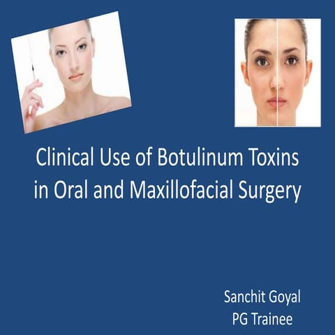 Clinical use of botulinum toxins in omfs | PPTX