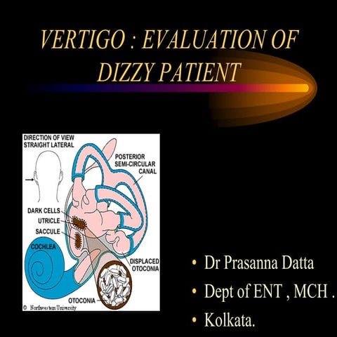 Clinic based management of vertigo. | PPT