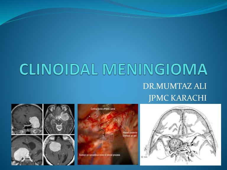 Clinoidal meningioma