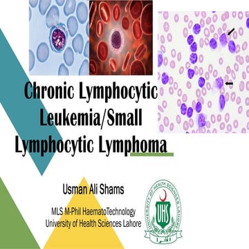Chronic Lypmhocytic leukemia/SLL/B-PLL/T-PLL/ATLL By SOLOMON SUasb by | PDF