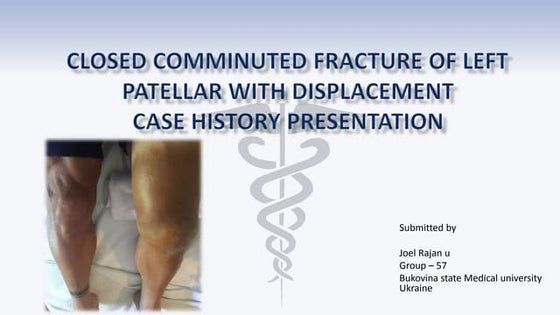 Patella Fracture | PDF