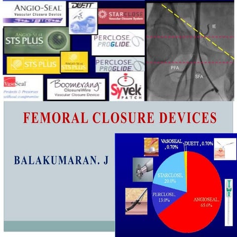 Closure devices | PPTX