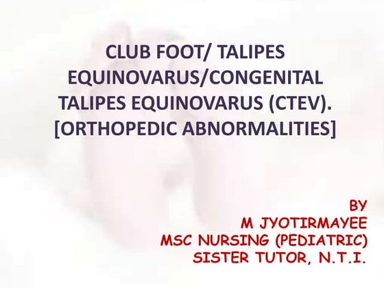 Clubfoot | PPT