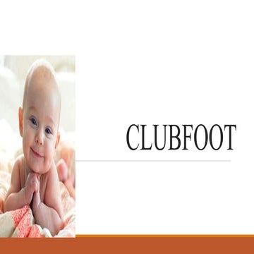 Clubfoot | PPTX