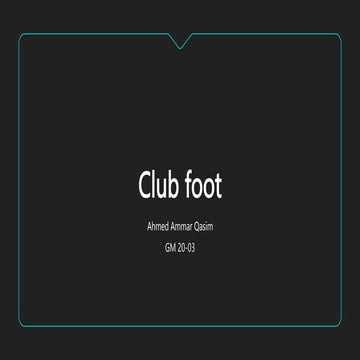 Club foot detailed lecture power point.pptx