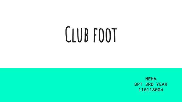 Club foot | PPTX