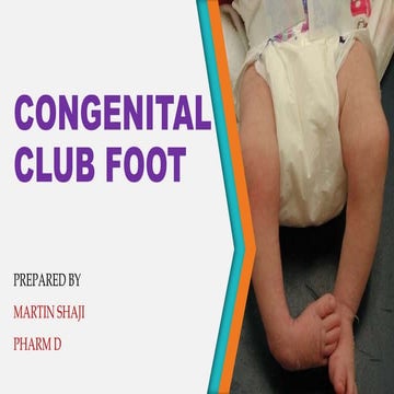Congenital Club foot-Medical information | PPTX