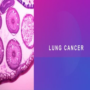 Lung Cancer Ppt