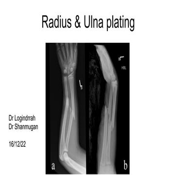 CME RADIUS ULNA PLATE ORTHOPEDIC POSTING | PDF