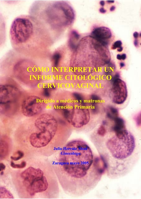 13 Citología Ginecológica. Citologia de endometrio. | PDF