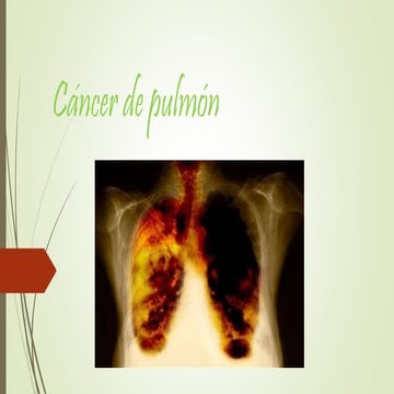 CÁNCER DE PULMÓN.pptx