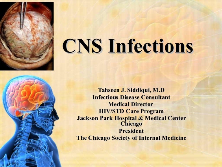 CNS Infections Siddiqui