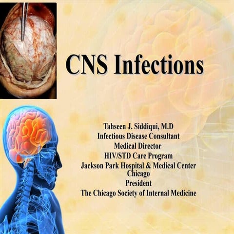 CNS Infections Siddiqui | PPT