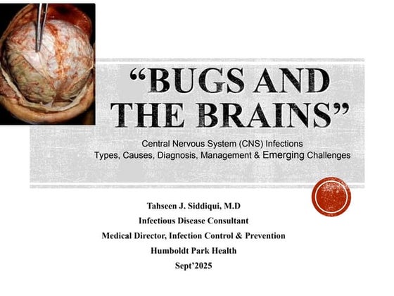 TOWNE VIEW of the skull. X-ray special procedure of skull. | PPTX