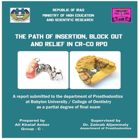 Co Cr RBD / the path of insertion, block out and relief | PDF