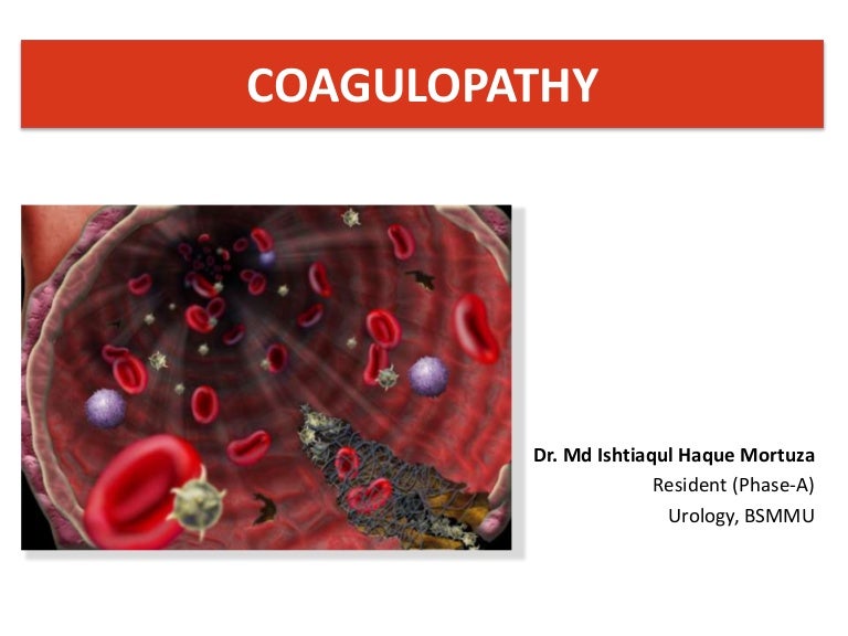 Coagulopathy