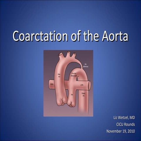 Coarctation - Wetzel | PPT