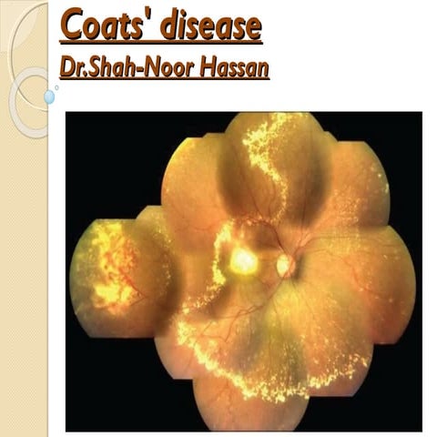 Coats' Disease | PPT
