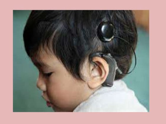 Cochlear Implant Surgery in Gurgaon (ENT INFOGRAPHY) | PDF
