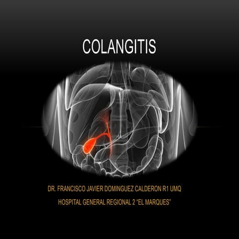 COLANGITIS EXPOSICION, definicion, diagnostico y tratamiento | PPTX