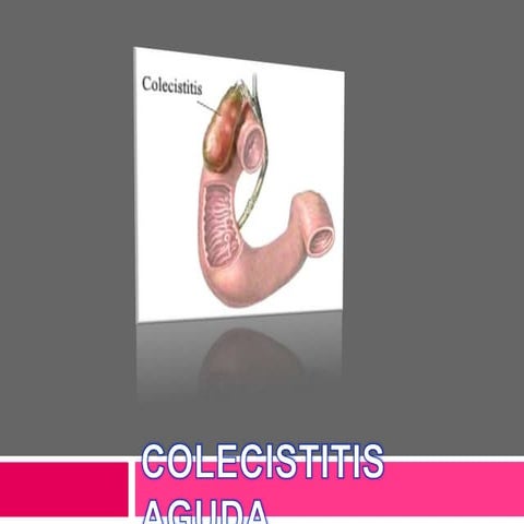Piocolecisto | PPTX