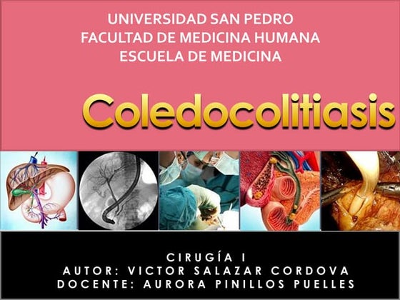 Coledocolitiasis | PPT