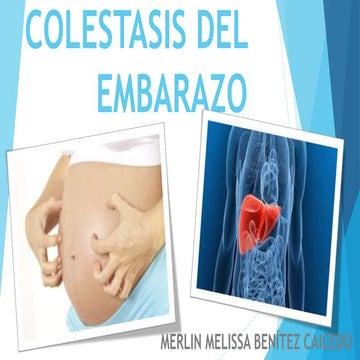 Colestasis del embarazo | PPTX