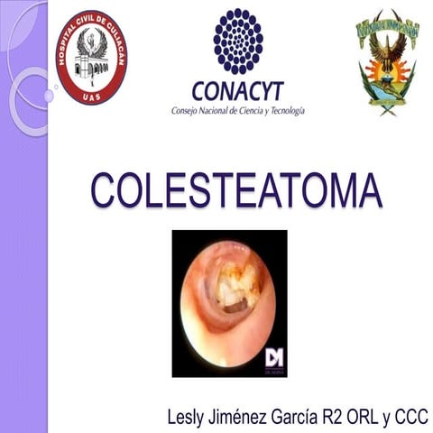 Otitis media crónica