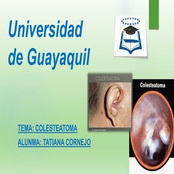 6.- Otitis Media Crónica y colesteatoma.pptx