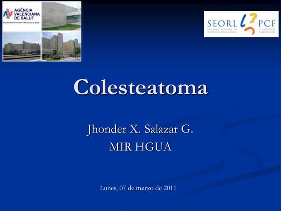 Chronic otitis media | PPTX | Ear, Nose and Throat Conditions ...