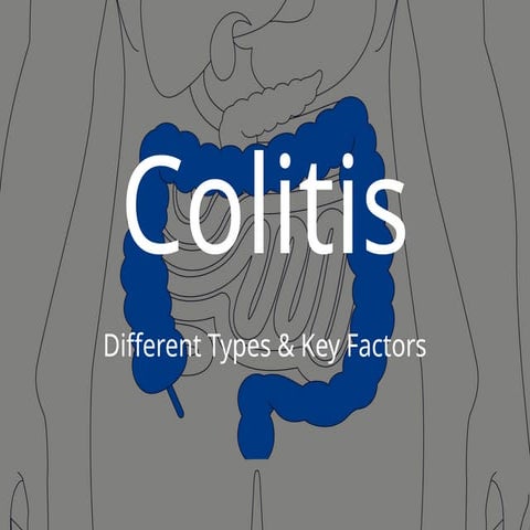 Colitis 10 slides breif (Main types and notes for each).pptx