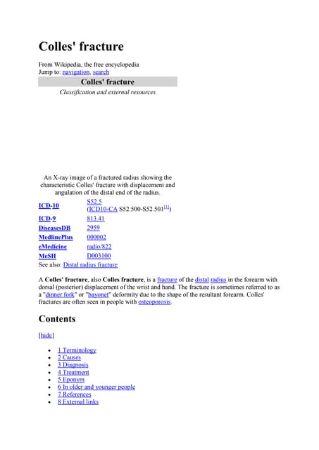 Colles fracture | PPTX