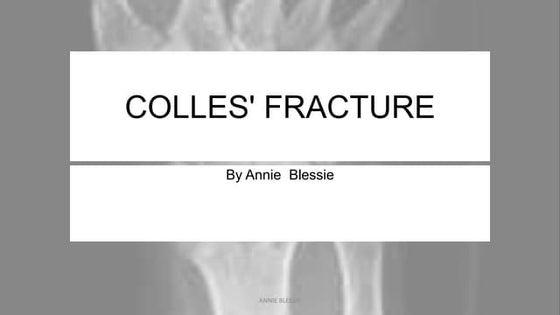 Distal End Radius Fractures - Colles, Smiths & Bartons | PPTX