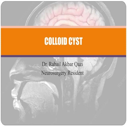 Colloid cyst | PPTX