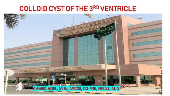 CHOROID PLEXUS PAPILLOMAS Presentation.. | PPT