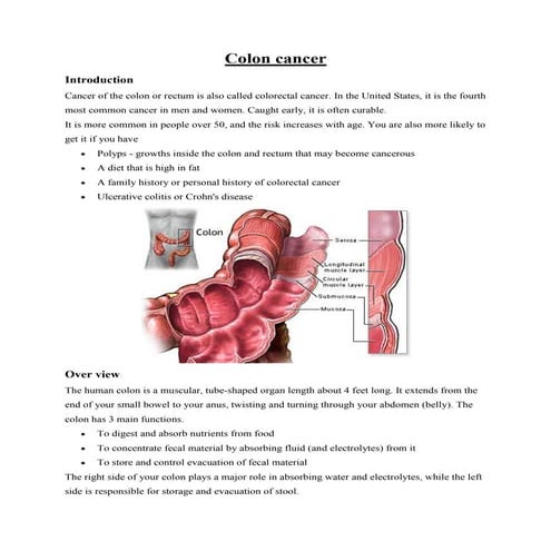 Colon cancer | DOCX