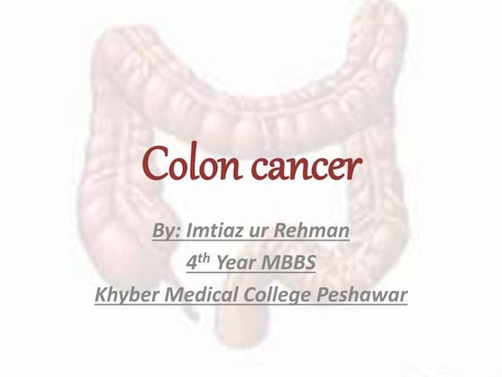Colon Cancer - Myths and Facts | PPT