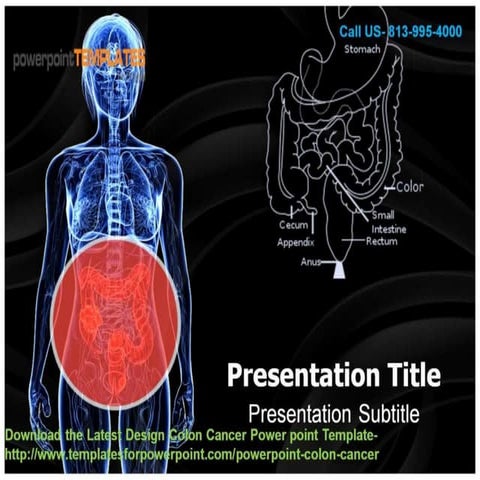 Latest Design Colon Cancer Power point Template | PPTX