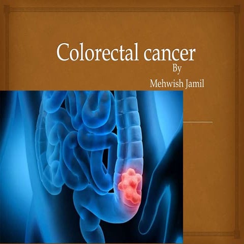 Colorectal cancer presentation | PPT