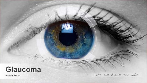 Glaucoma | PPT