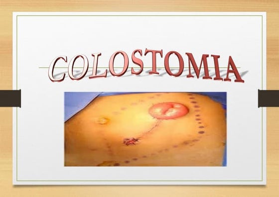 COLOSTOMIA - TECNICA QUIRURGICA E INSTRUMENTAL | PPT