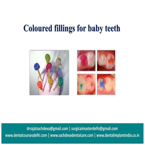 Coloured fillings for baby teeth | PPTX