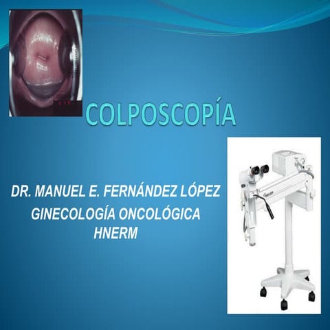 Histologia del cervix | PPTX
