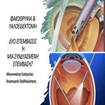 ΣΥΝΔΥΑΣΜΕΝΗ ΕΠΕΜΒΑΣΗ ΦΑΚΟΘΡΥΨΙΑΣ ΚΑΙ ΥΑΛΟΕΙΔΕΚΤΟΜΗΣ | PPTX