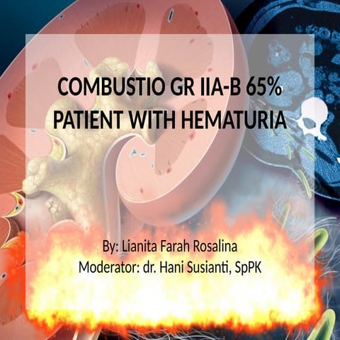 COMBUSTIO GR IIA-B 65% PATIENT WITH HEMATURIA.pptx