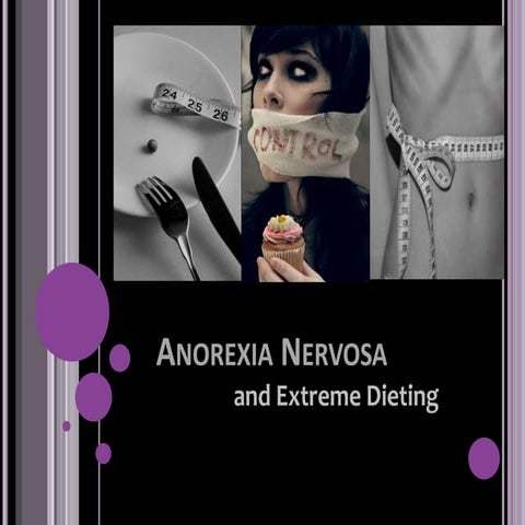 Anorexia Nervosa Symptoms Guide | PDF
