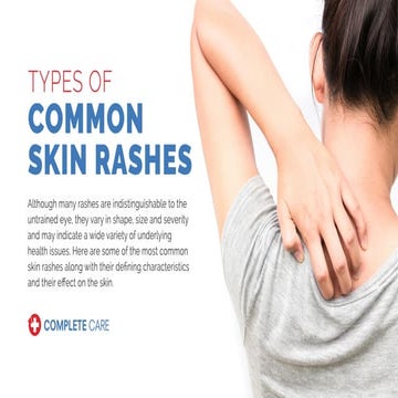 Types of Common Skin Rashes | PPT