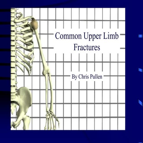 Common Upper Limb Fractures | PPSX