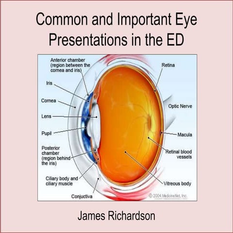Eye presentations to the Emergency Department | PPTX