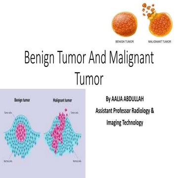 Malignant Tumor Microsurgical Management Of Giant Malignant Peripheral